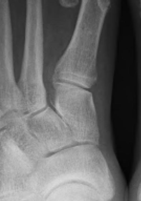 Background | The Bone School